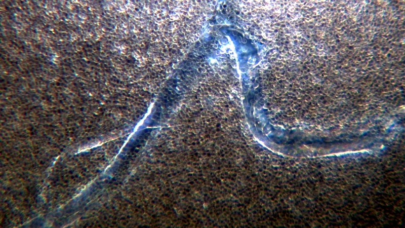 Zombie Blood - COVID19 Embalmed Blood For Over 2 Years Shows Continued ...